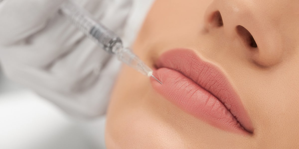 Exploring the Trending Lip Flip Procedure: What You Need to Know ...